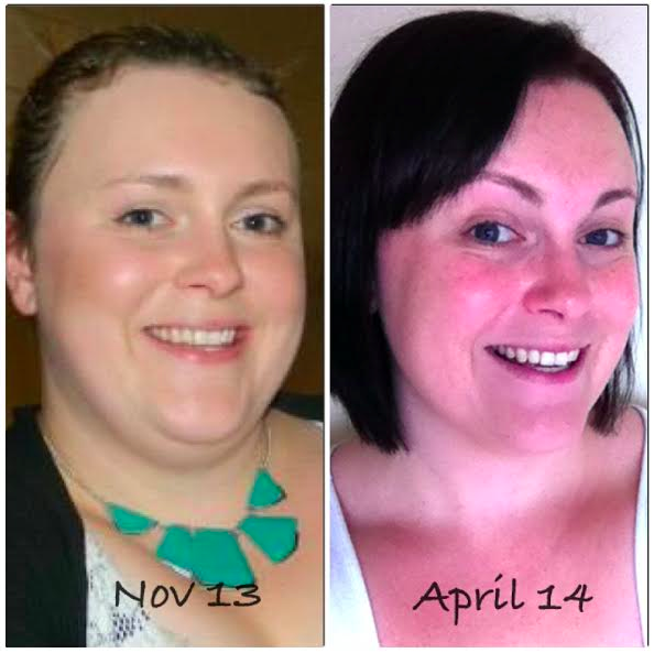 Sarah Has Lost 10kg With Lose Baby Weight - Lose Baby Weight Sarah Has Lost 10kg With Lose Baby Weight - Lose Baby Weight